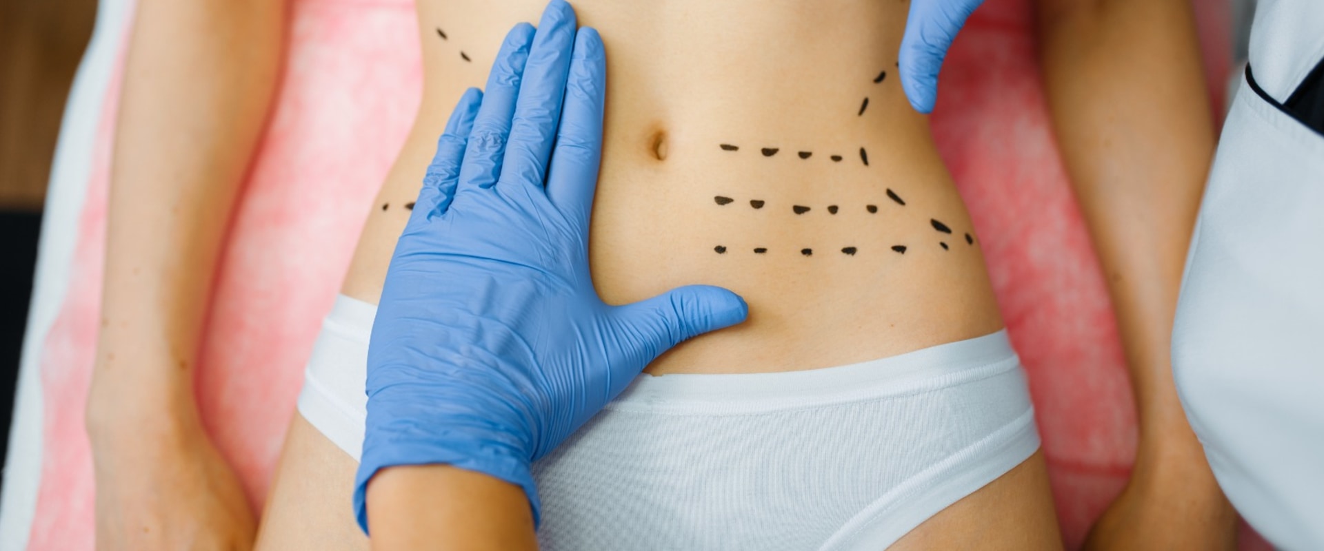 The Recovery Process for Non Surgical Liposuction: What to Expect